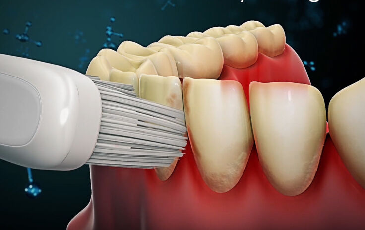 The Silk’n ToothWave Makes It Simple To Bring Light To The Start Of The ...