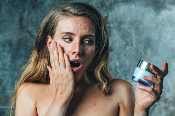 Five Experts Answer 2021's Most Asked Questions About Sensitive Skin