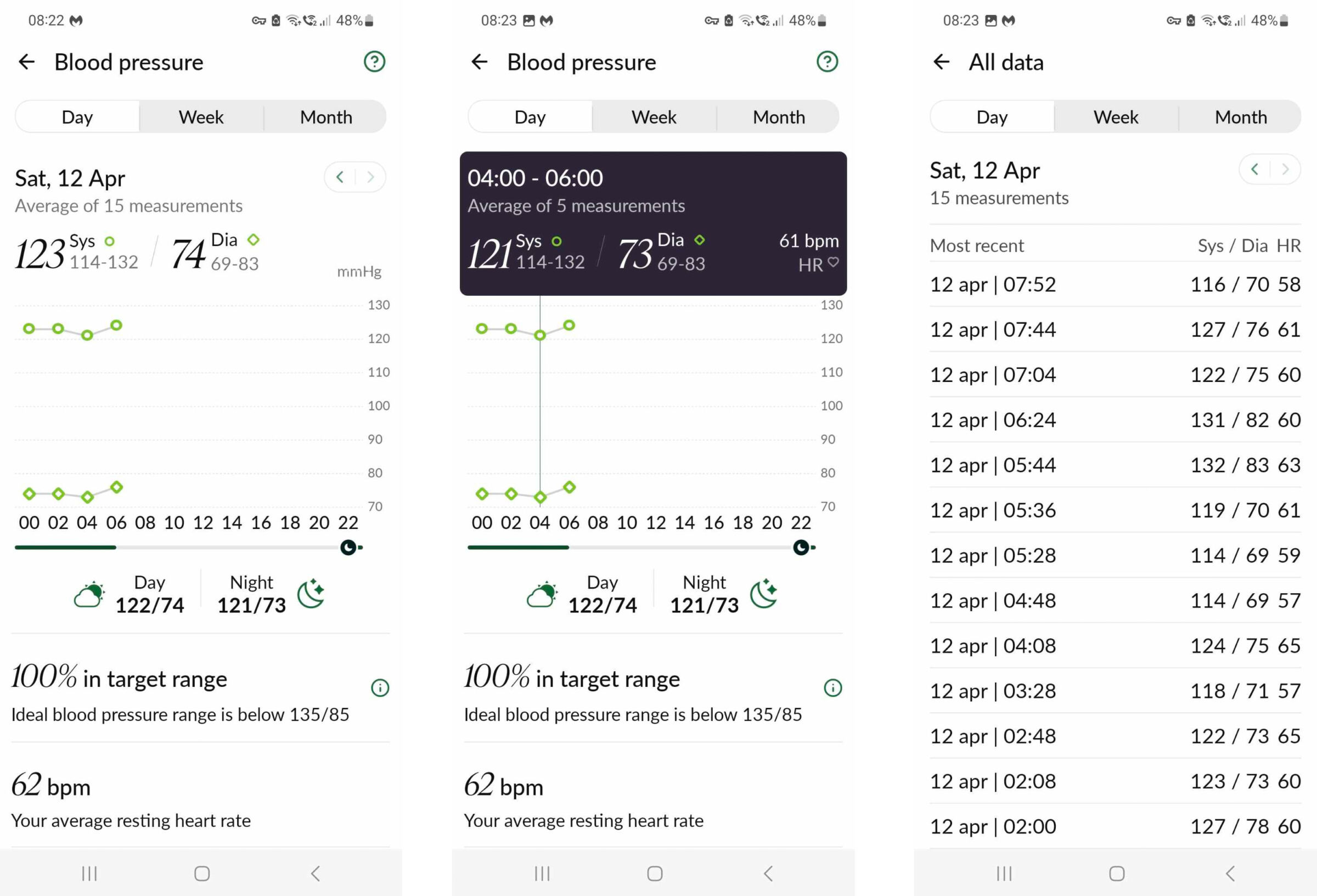 We Review The Hilo Band, A Device That Monitors Blood Pressure 24/7